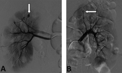 Abdomen Flashcards | Memorang