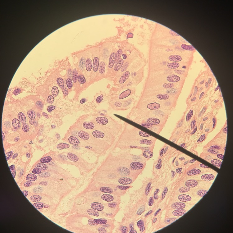 Histology Flashcards | Memorang