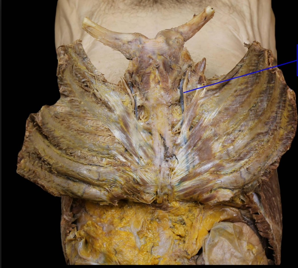 Intercostal Nerves Cadaver LabLink - BlueLink