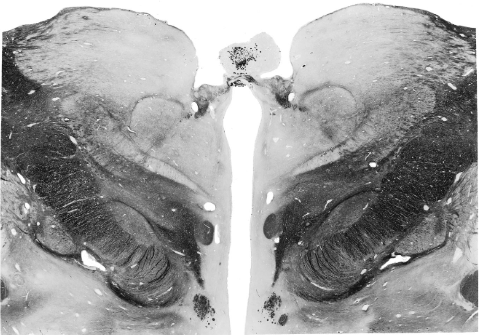 SD3 Flashcards | Memorang