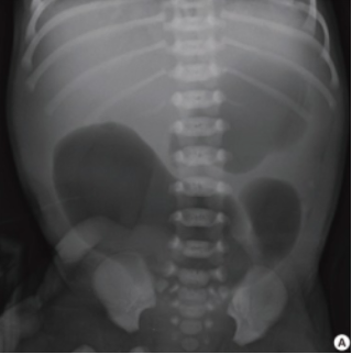 Abdomen Flashcards | Memorang