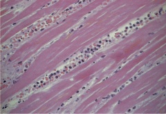 Learning Set Flashcards | Memorang