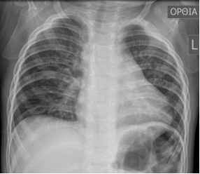 Thorax and Spine Flashcards | Memorang