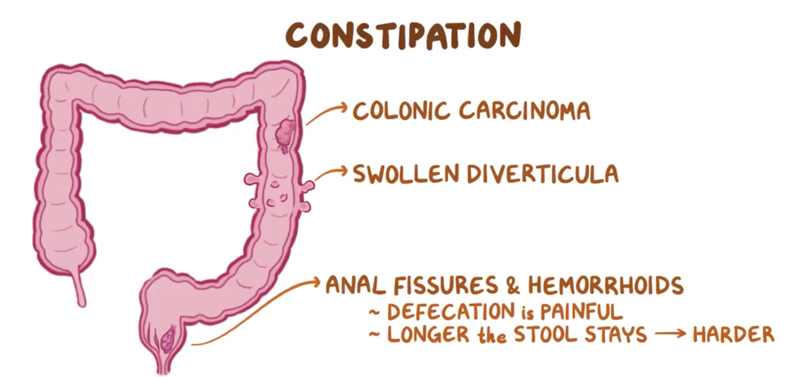 Laxatives/Cathartics Flashcards | Memorang