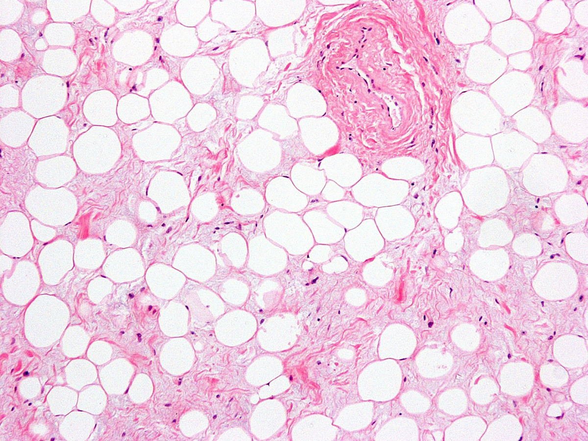 Adipose Loose Connective Tissue