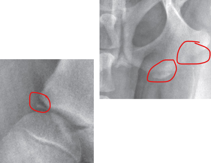 Heup, bekken en perineum Flashcards | Memorang