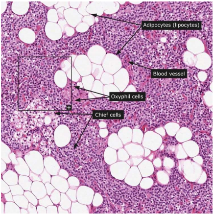 Parathyroid Histology Labeled