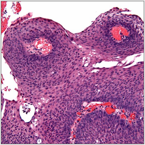 Cervix Flashcards | Memorang