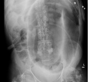 Abdomen Flashcards | Memorang