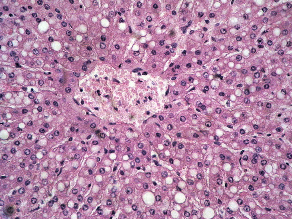 upr 4 Flashcards | Memorang