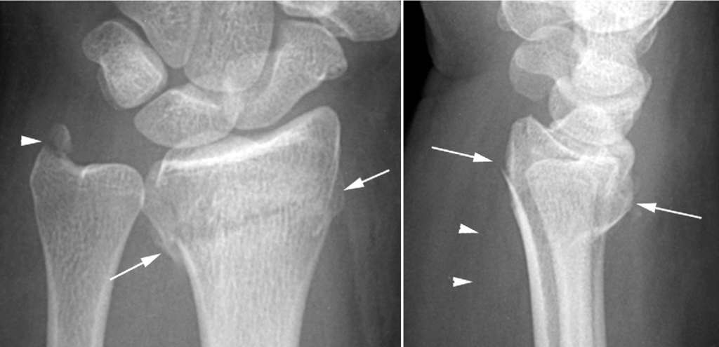 Wrist and Hand Pathology Flashcards | Memorang