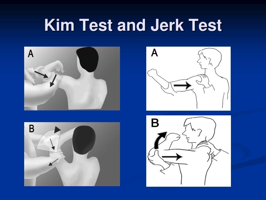 Shoulder Special Tests Flashcards | Memorang