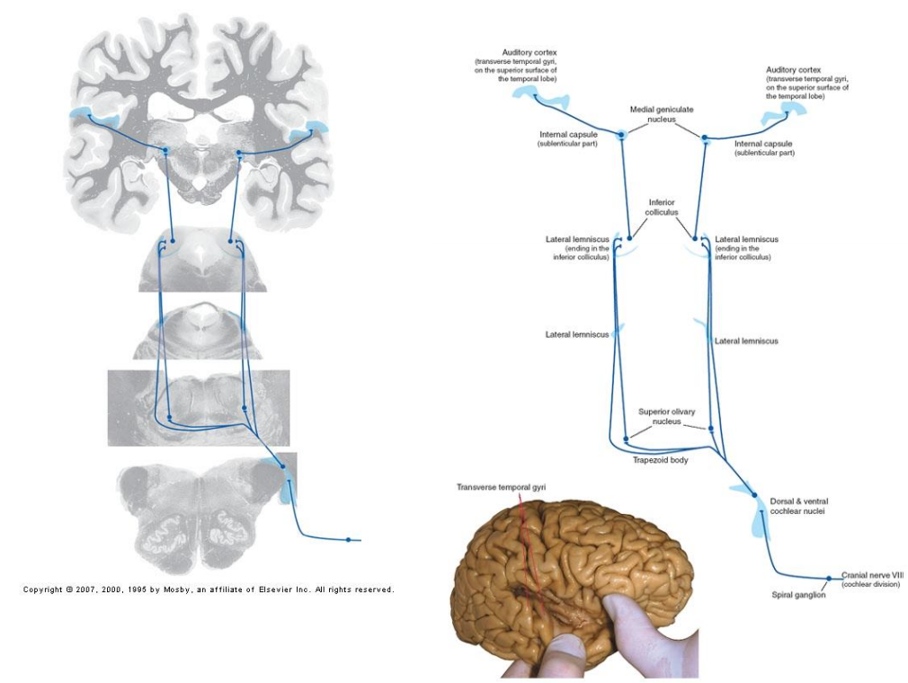 Lateral Lemniscus