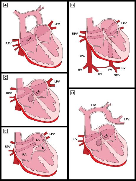 PP-Cardiology Flashcards | Memorang