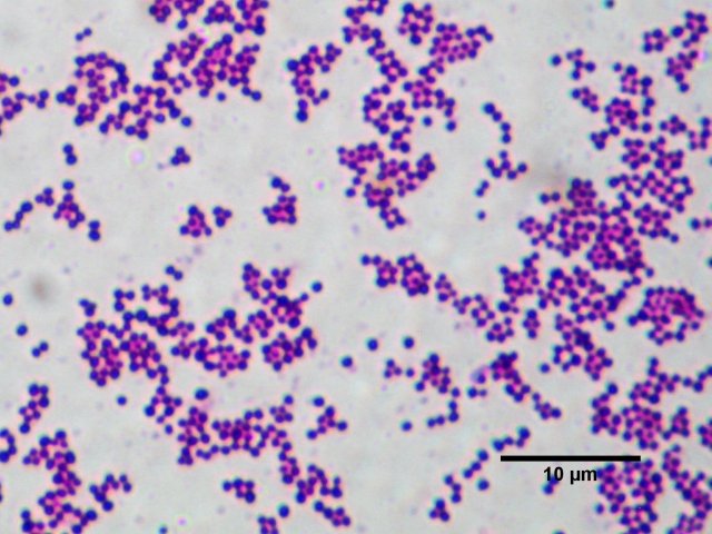 Staphylococcus Epidermidis 1000x