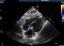 Radiology Flashcards | Memorang