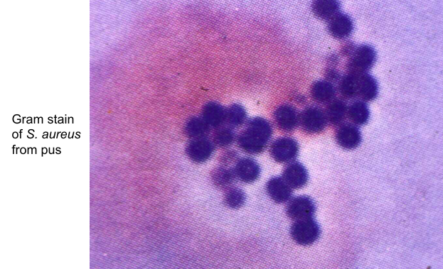 Staph Flashcards | Memorang