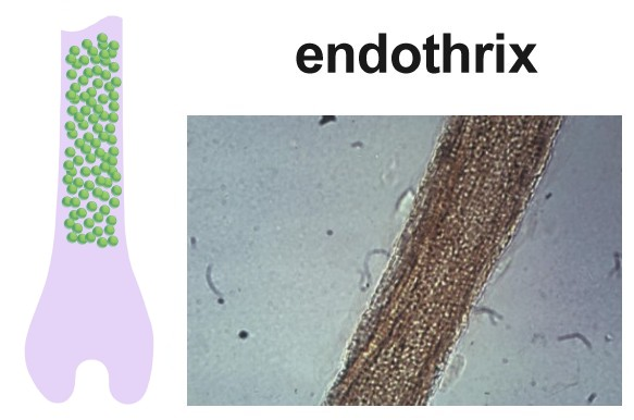 Fungal diseases Flashcards | Memorang
