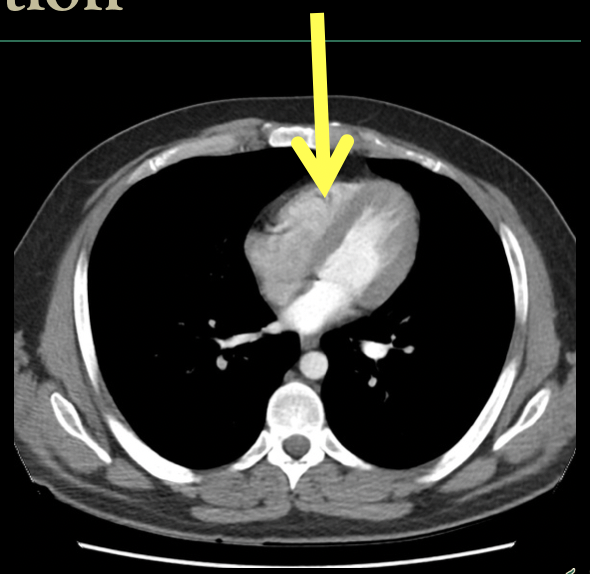 C7T3L14-16 Imaging Review I, II, III Flashcards | Memorang