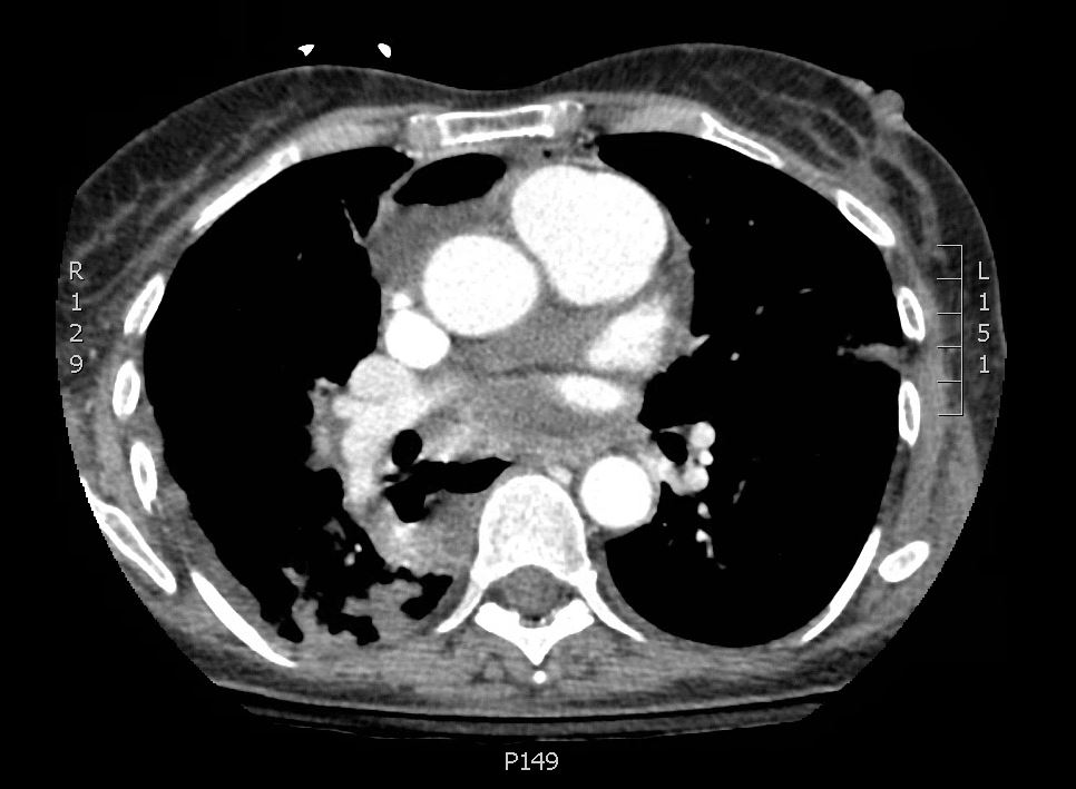 Imaging Flashcards | Memorang
