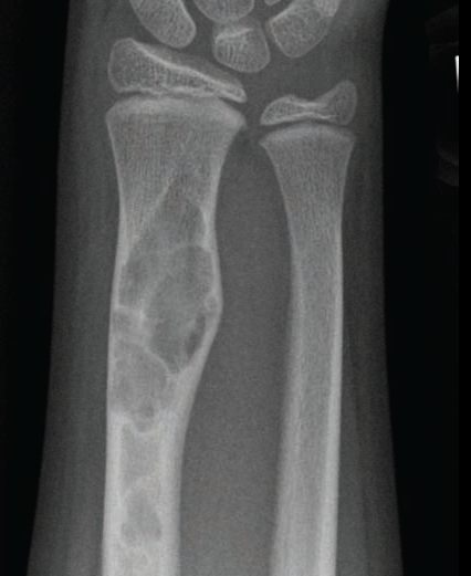 CORE Flashcards | Memorang