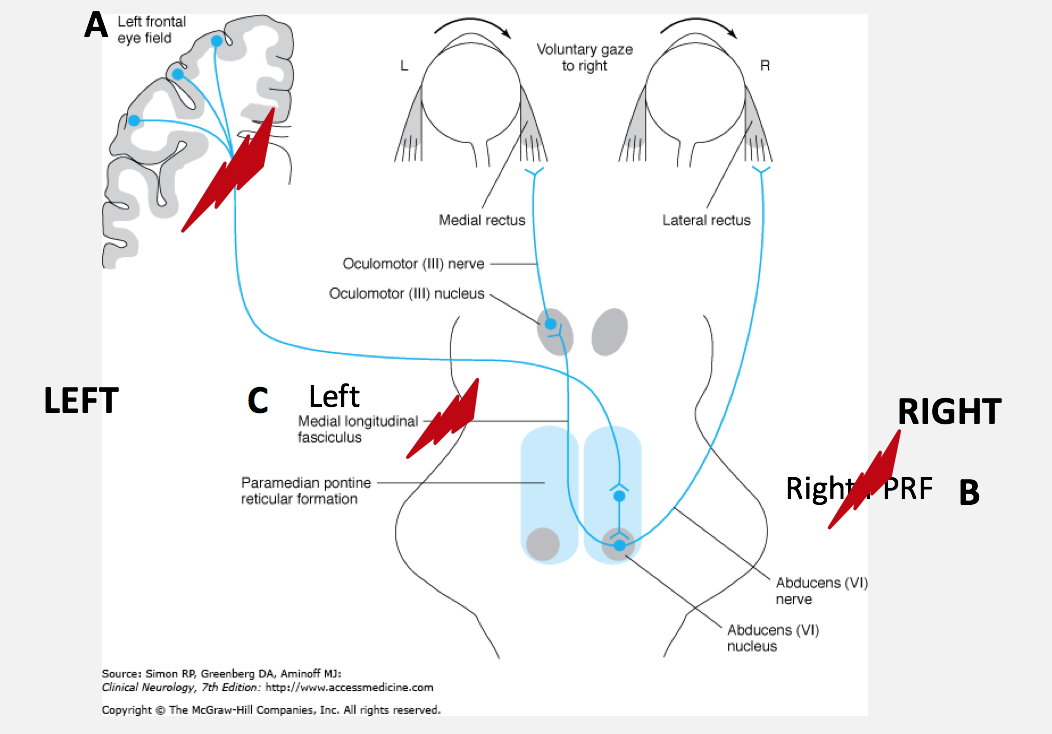 Corticobulbar Tract Cross Section