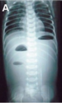 Abdomen Flashcards | Memorang